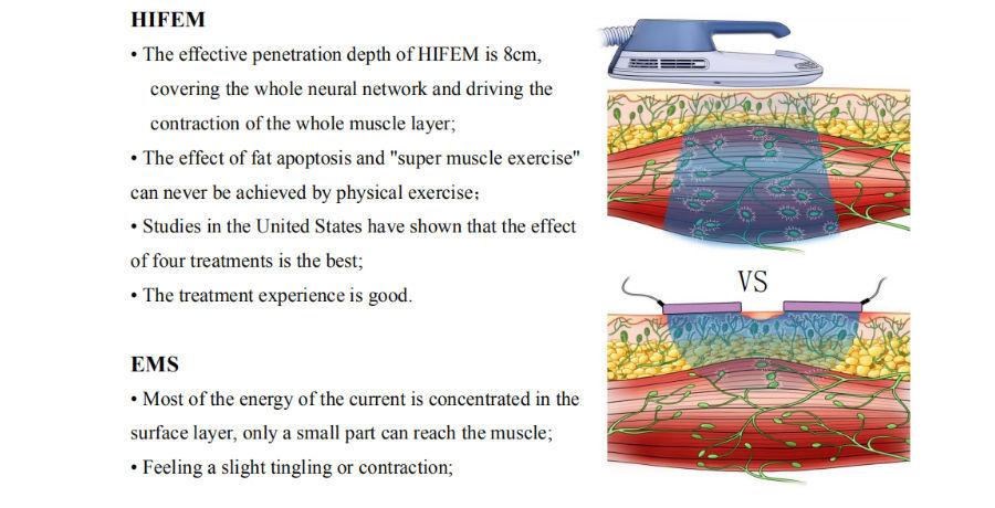 Non-invasive HIFEM Machine for fat burning and muscle building, Non ...