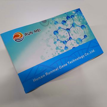 ChinaRunmei vtm test turkey with sample swab,nasal swab with inactive ...