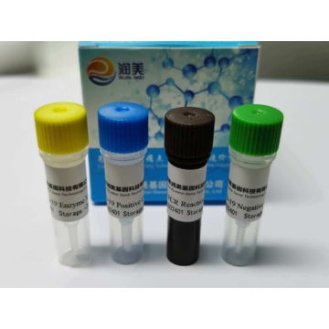 ChinaSpin Column Method Nucleic Acid Extraction Kit on Global Sources