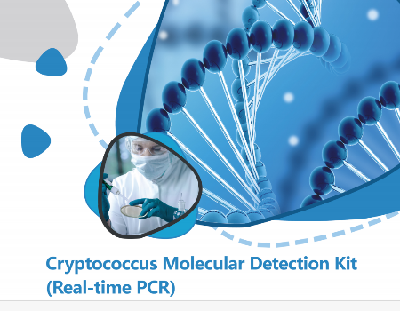 ChinaCryptococcal Capsular Polysaccharide Detection Kit(PCR ...