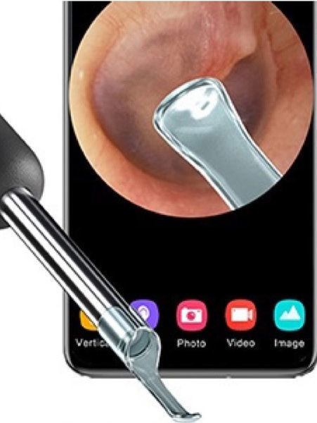 China Ear scrapers Ear Wax Removal Cleaner Otoscope WiFi Ear Camera Ear ...