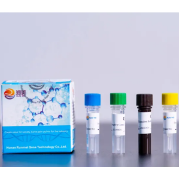 China Ce Approved Sansure Real Time PCR Rapid Test Kit Nucleic Acid ...