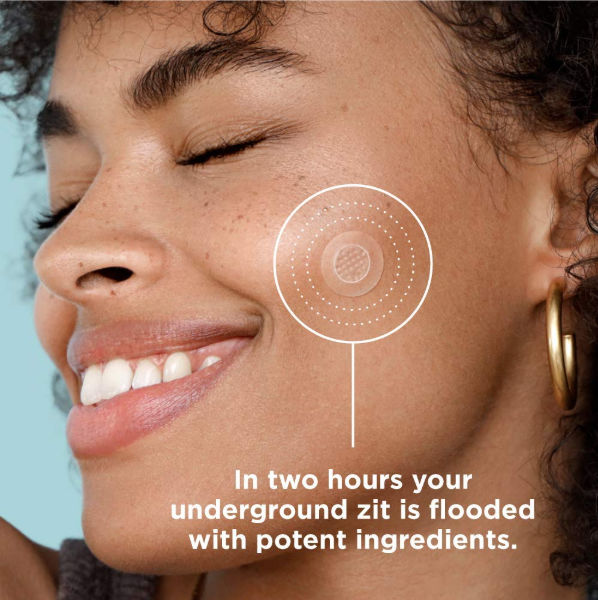 China Hot Sales translucent micro needle acne pimple patch for deep ...