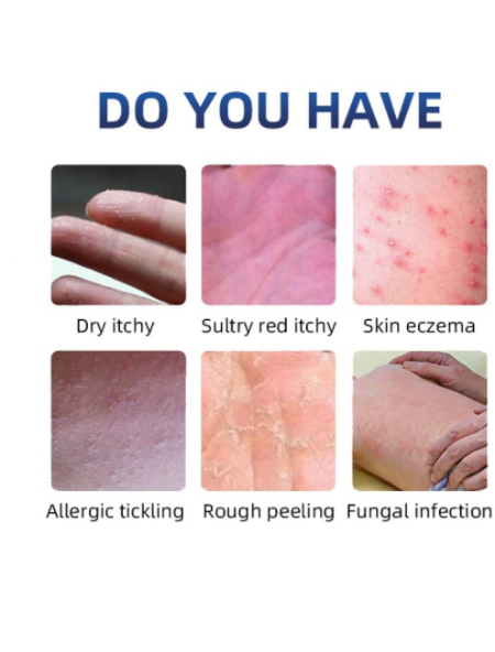 Topical skin plaster bacteriostatic ointment cowhide moss cream ...