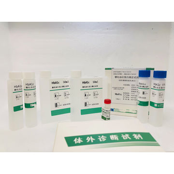 China Unique Design Hot Sale Total Bile Acid Assay Kit TBA blood test ...