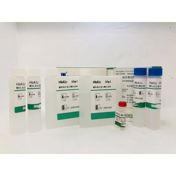 China Unique Design Hot Sale Total Bile Acid Assay Kit TBA blood test ...