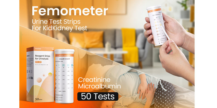 China Femometer Kidney Infection Test Strips, Early Kidney Injury Test ...