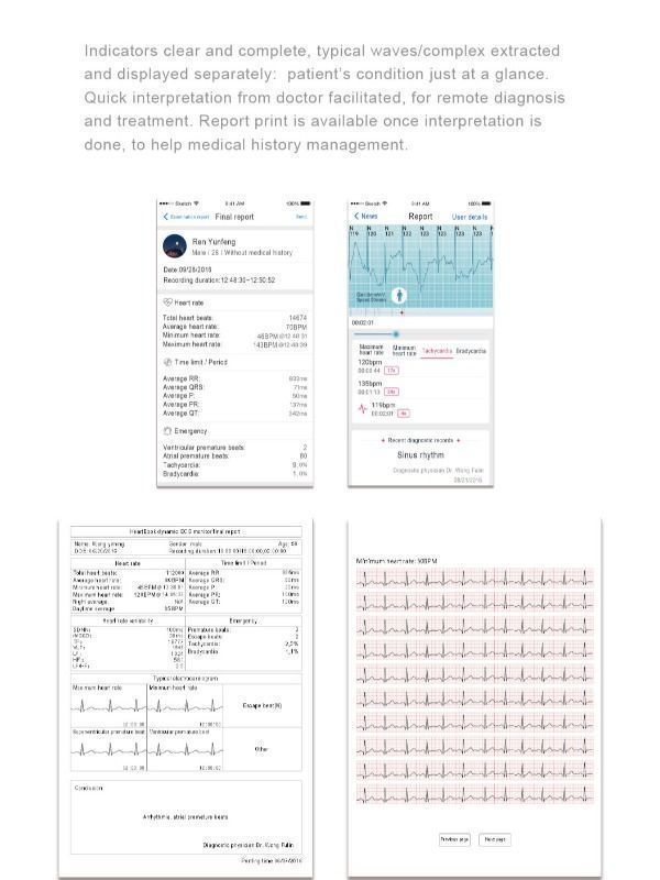 China 1 channel ecg holter cardioscan machine ecg portable monitor for ...