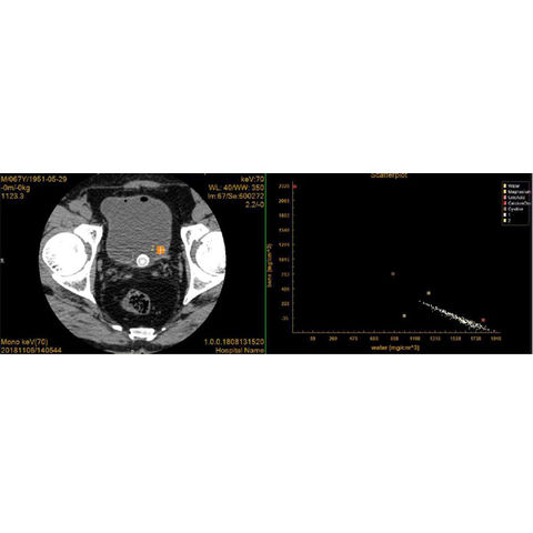 China CT Scanner 32 Slice Human CT Scan Machine Medical CT Imaging ...