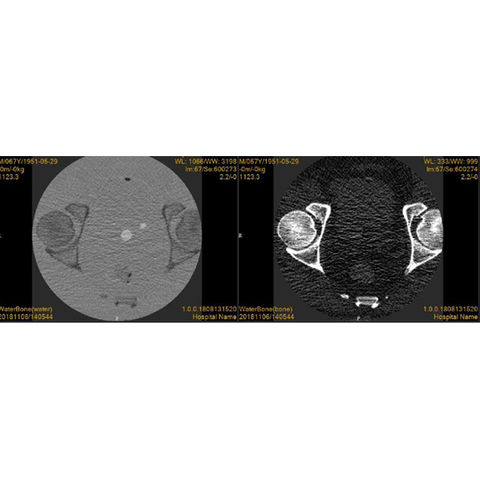 China CT Scanner 32 Slice Human CT Scan Machine Medical CT Imaging ...