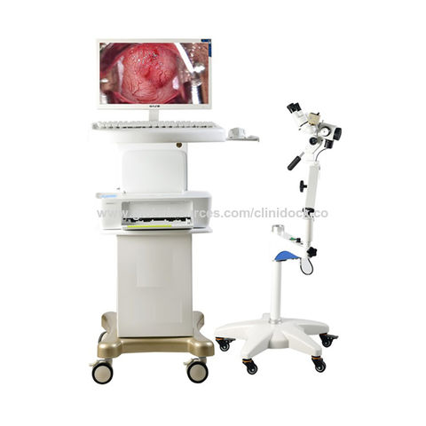 China Medical camera system colposcope Specialized digital optical high ...