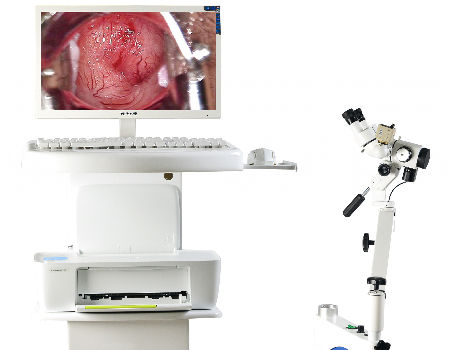 Hot sale Camera Microscope Medical Optical Vaginal Instrument Popular ...