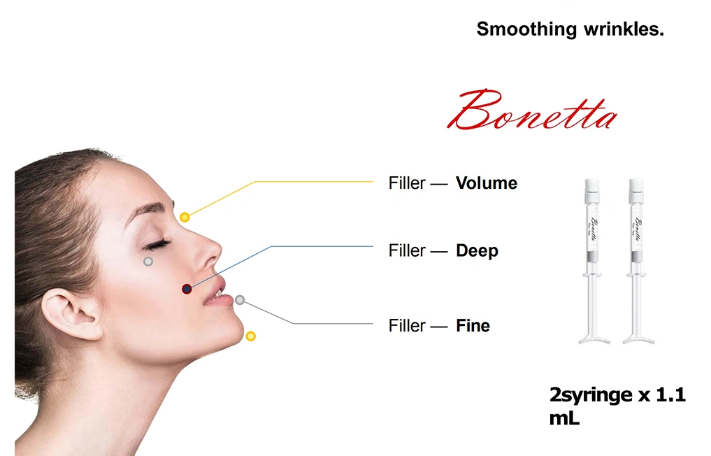China Hyaluronic Acid Dermal Filler Bonetta 2*1.1ml for face lips nose ...