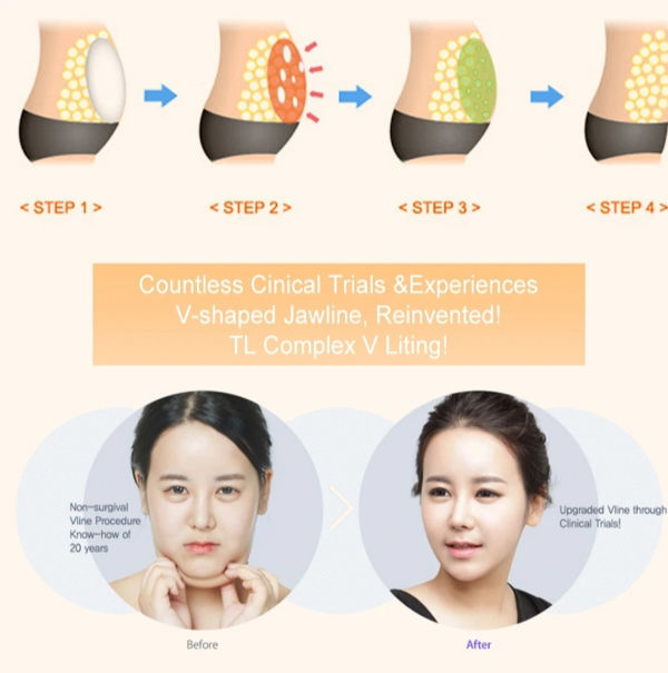 China Korean VLine Lipodissolve Injection for Body fat melting on ...