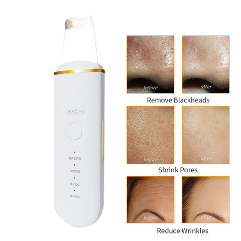 China Deep clean facial skin scraper electric ultrasonic skin scrubber ...