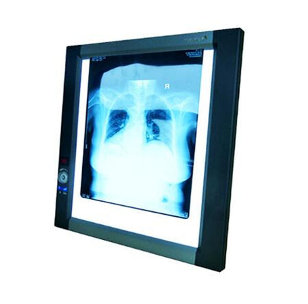 China Portable Medical single LED x ray portable film viewer Film ...