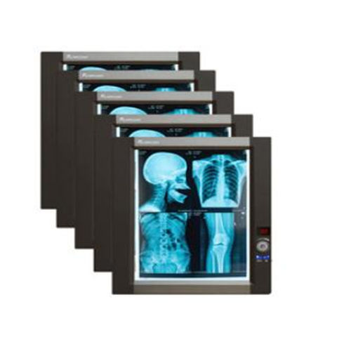 China Portable Medical single LED x ray portable film viewer Film ...