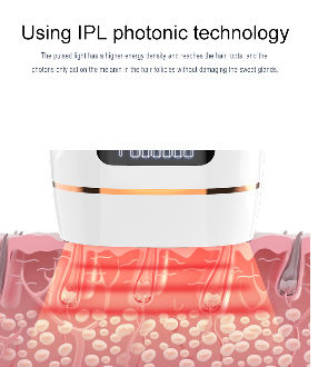 China IPL freezing point hair removal device for ladies on Global ...