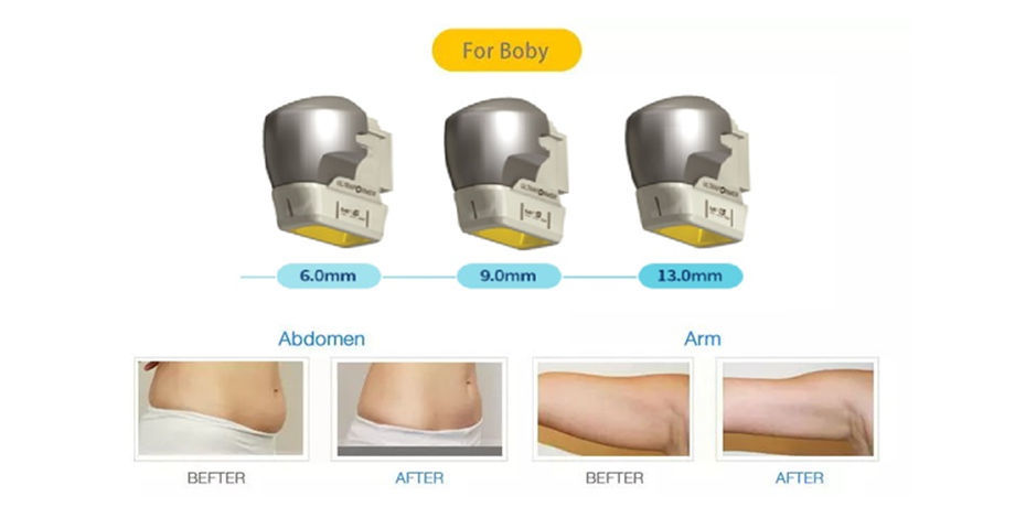 China 2021 7D Hifu Focused Ultrasound fat reduction HIFU Body And Face ...