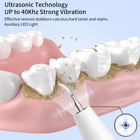 China Dental Calculus Plaque Remover Tool Kit,Electric Tooth Tartar ...