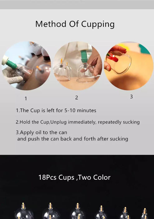 China Therapy Massage cupping best Acupuncture needles Vacuum Cupping ...