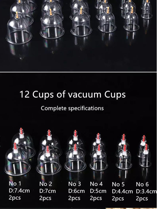China Therapy Massage cupping best Acupuncture needles Vacuum Cupping ...