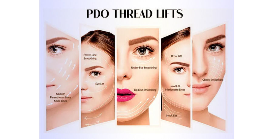 China 3d pdo thread 4D Cog Thread L Blunt cannula face lift thread for ...