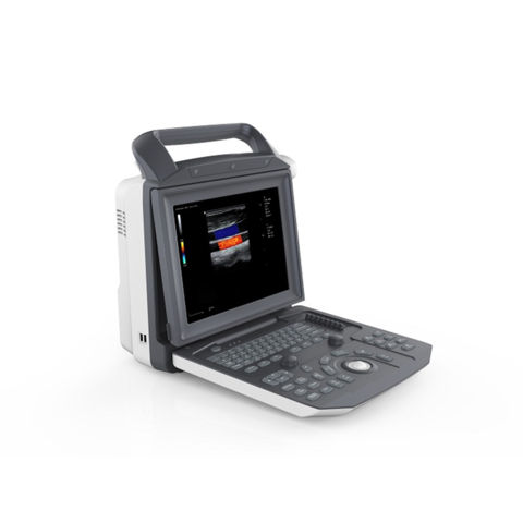 China Full-digital Color Doppler Ultrasound System on Global Sources ...