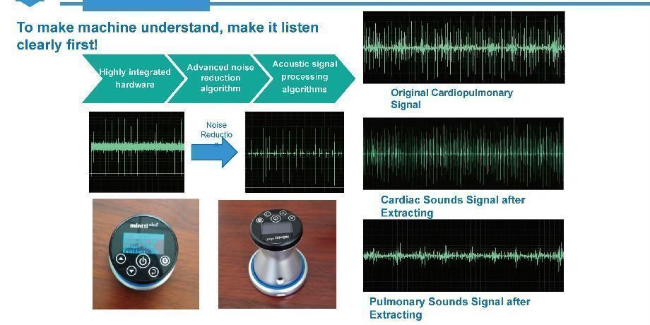 China Wireless Stethoscope medical equipment Digital stethoscope ...