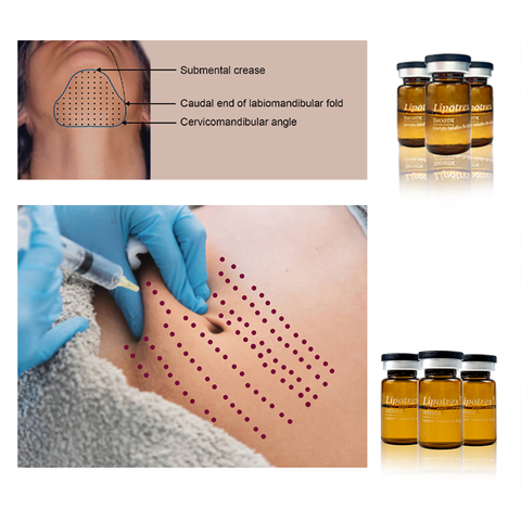 China Lipolytic injection slimming lipolysis solution lipolyse ...