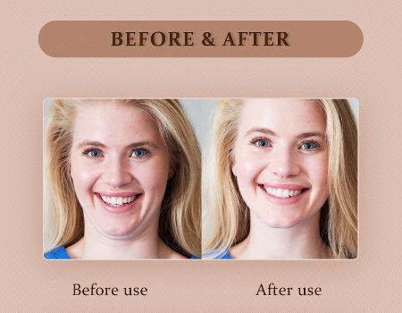 Meso fat injection liquid lipo fat dissolver lipolytic solution ...