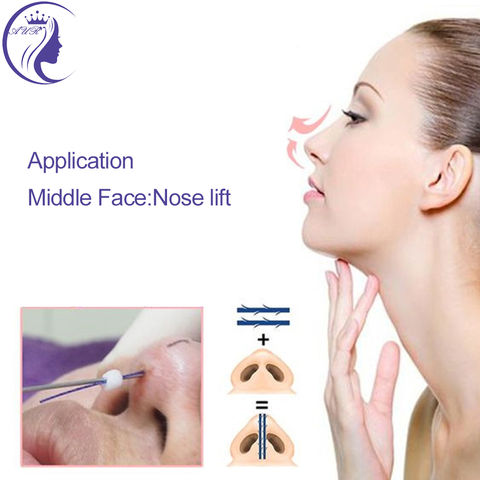 China Best selling products barbed pdo thread lift korea absorbable pdo ...