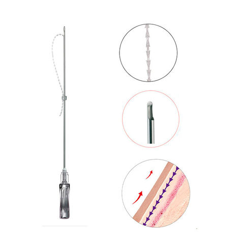 China Collagen regeneration absorbable 18G 100mm fish bone thread PCL ...