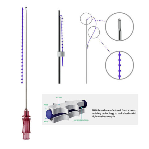 China Collagen regeneration absorbable 18G 100mm fish bone thread PCL ...