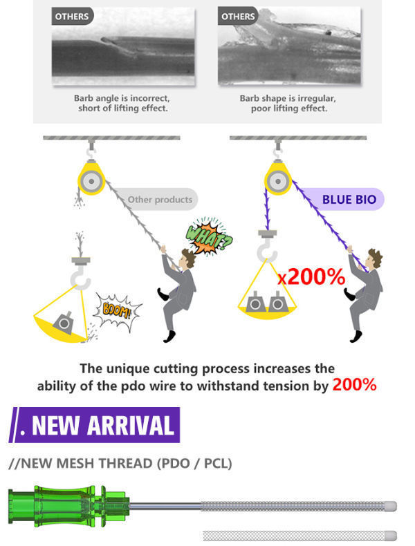 China Barbed double needle thread v lift face abosorbable thread ...