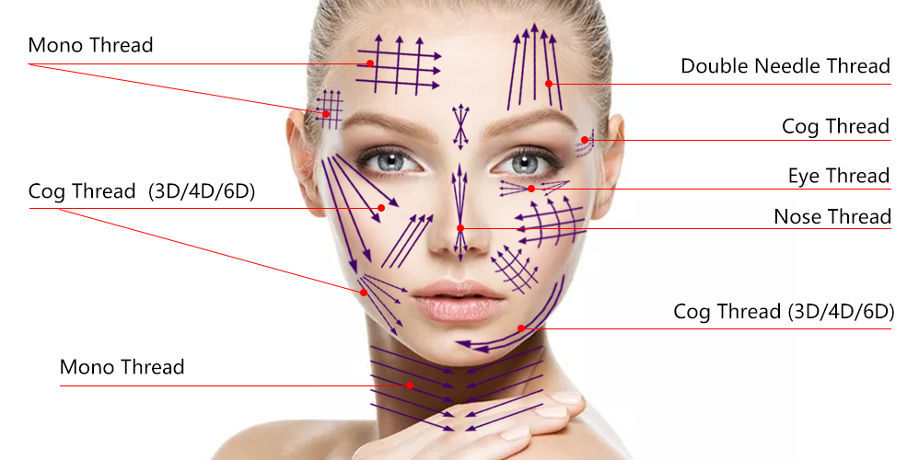 China Thread Molding Cog hilos tensores anchor pdo thread for face and ...