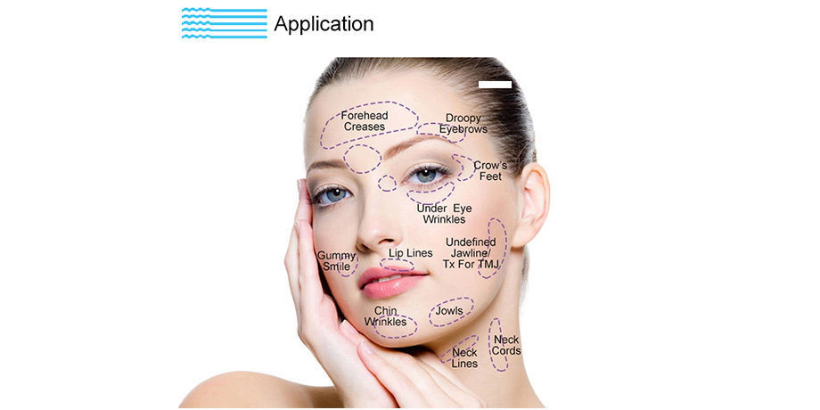 China Botox injection 100 unit jeuveau protine jeringas smile lines ...