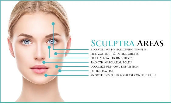 Plla Filler Sculptra Injectable Aesthetic Dermal Filler Sculptra Buttk ...