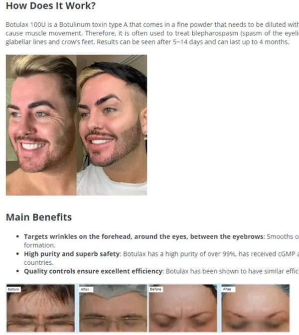 Korea Botu lax′ S Meditoxin′ S 100u 200u Type a Nabota′ S Botulinum's ...