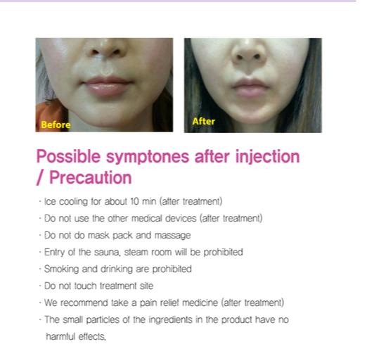 Korea Lipo Lab V Line Premium Best Way to Losing Weight Face Double ...