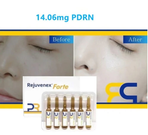 Mesotheraphy Rejuran Forte Skin Rejuvenation Skin Booster Salmon DNA ...