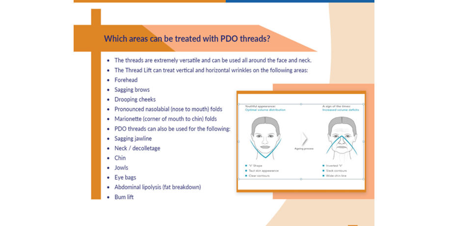 Plla Pcl Fishbone Molding Pdo face-anti aging threads face lifting ...