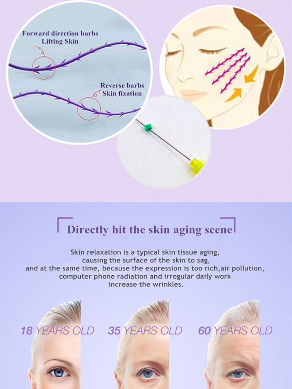 CE Approved Best Quality Best Selling Eye Bag Lift Mono Screw 30g25mm ...