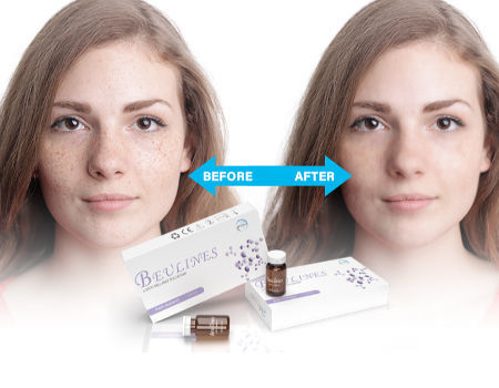 Acne & Blemish Treatment Skin Purifying Face Hyperpigmentation Korean ...