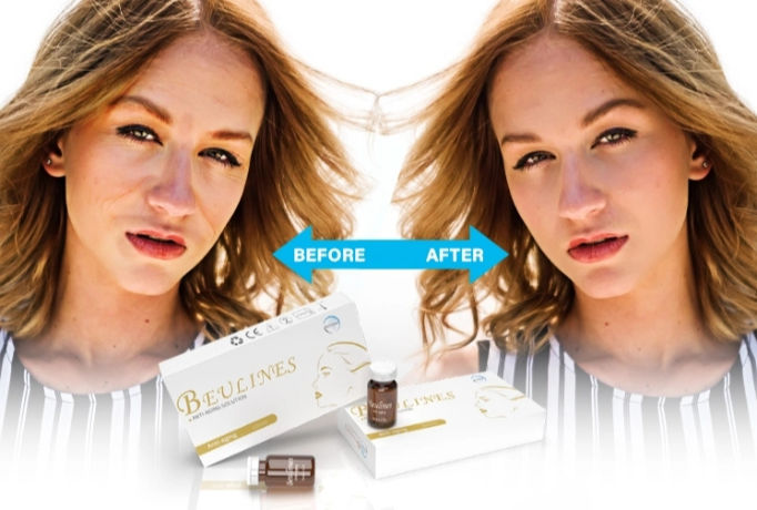 Meso Hyaluronic Acid Serum Injection Anti-Wrinkle Anti Aging Ha ...