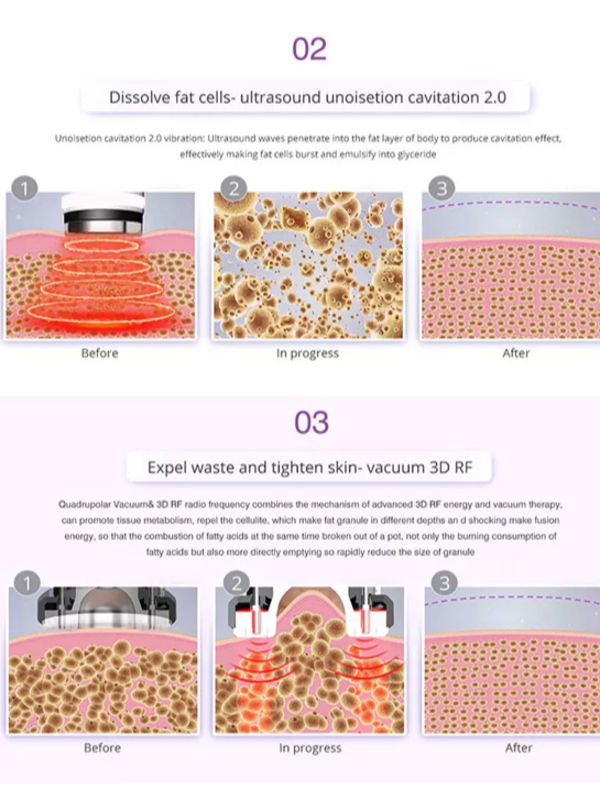 Buy Wholesale China Hottest Vacuum Cavitation System Lipo Laser ...