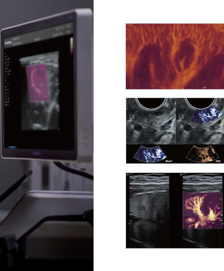 New Arrival 3d/4d/5d Color Doppler Scanner Trolley Echografo For ...