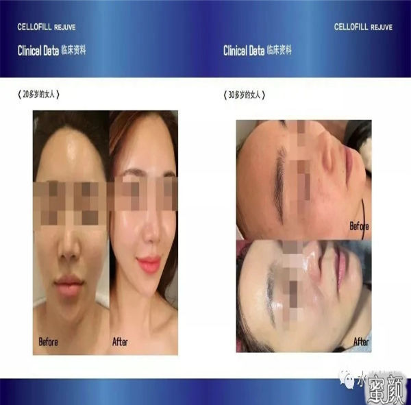 Buy Wholesale China 2022 New Product Korea Cellofill Hc Revitalizing ...