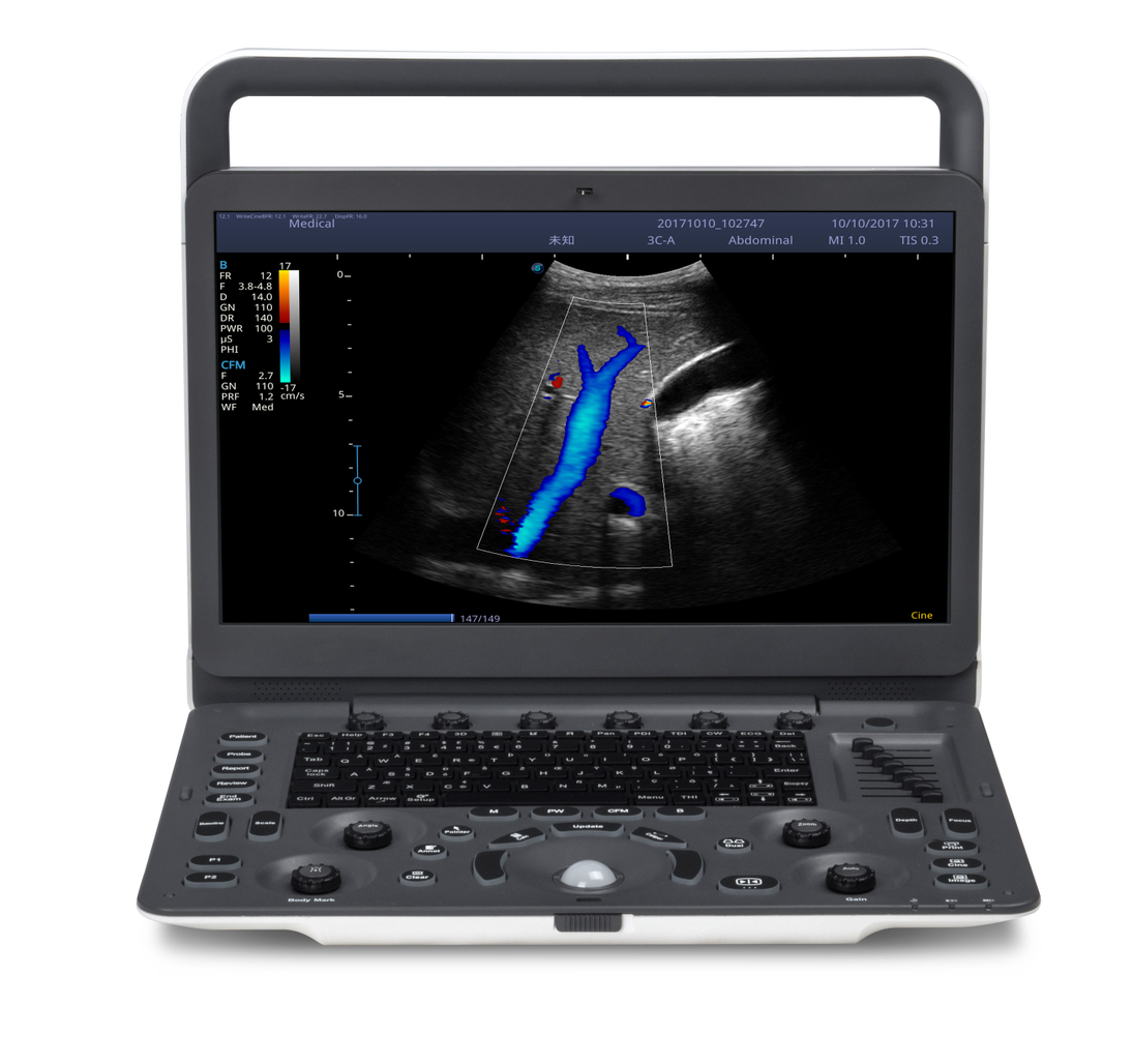 Buy Wholesale China Ce,iso Marked High Performance Ultrasound Machine ...