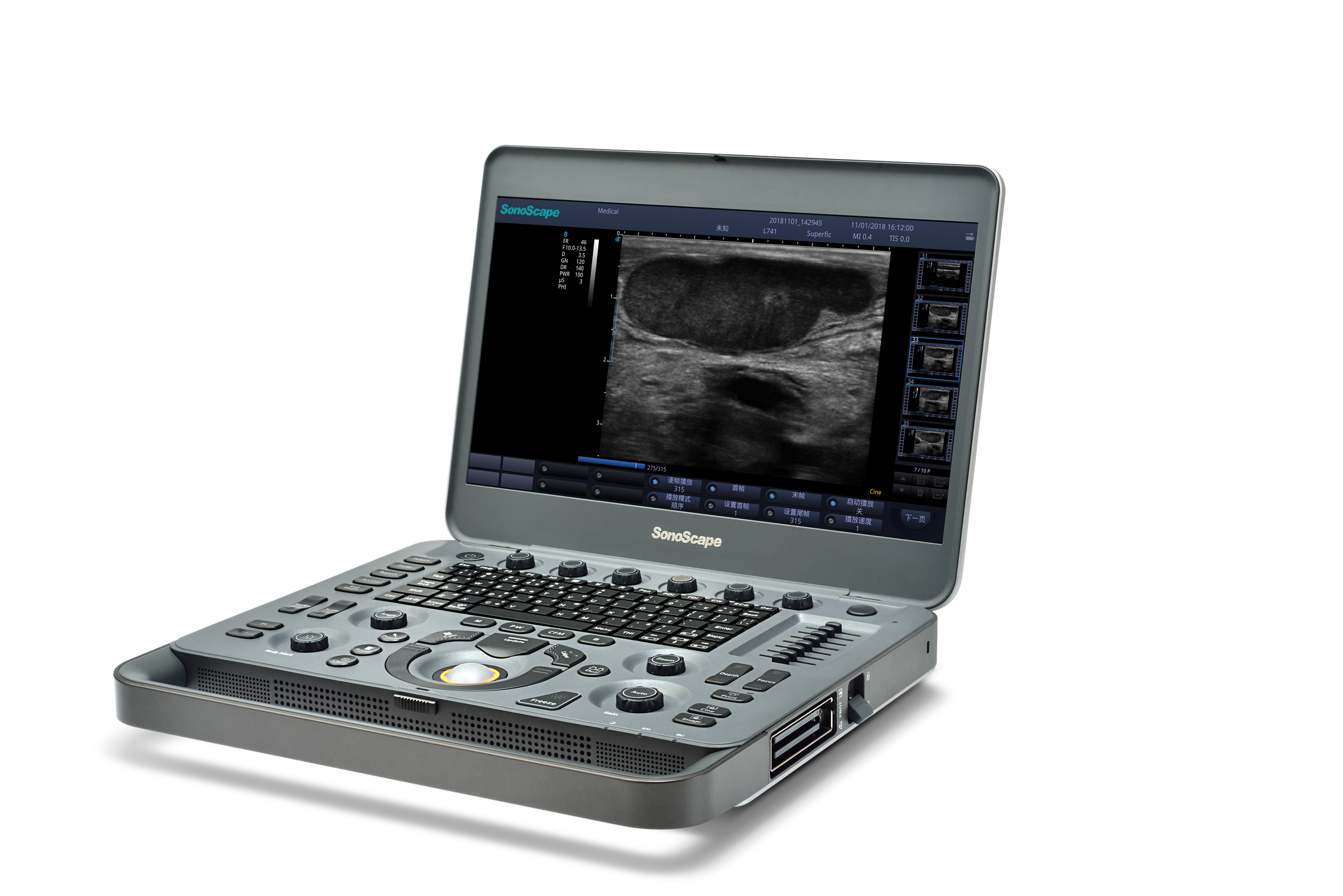 Buy Wholesale China Ce,iso Marked High Performance Ultrasound Machine ...